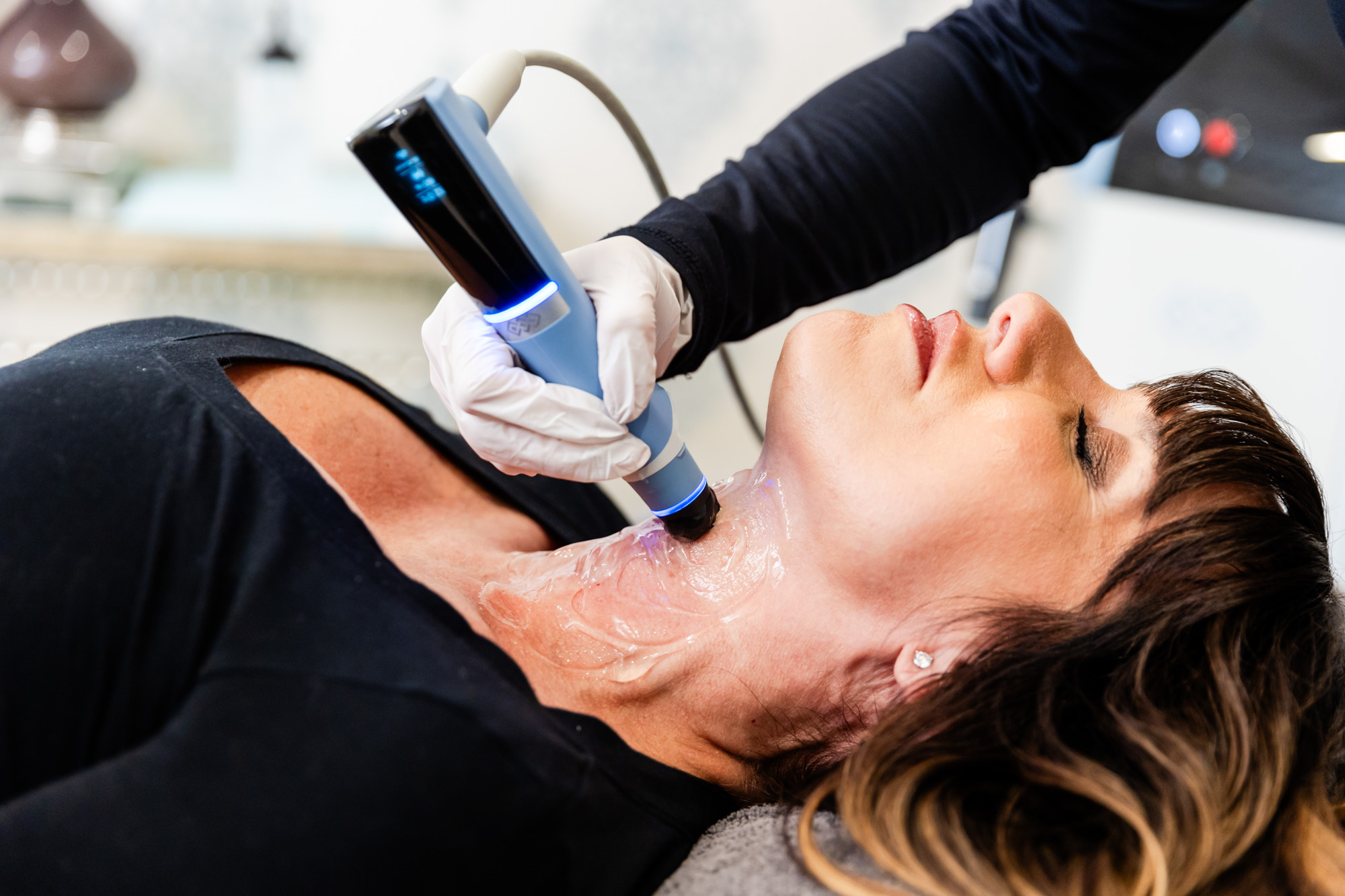 Body Tightening Scottsdale AZ | Exion Skin Tightening
